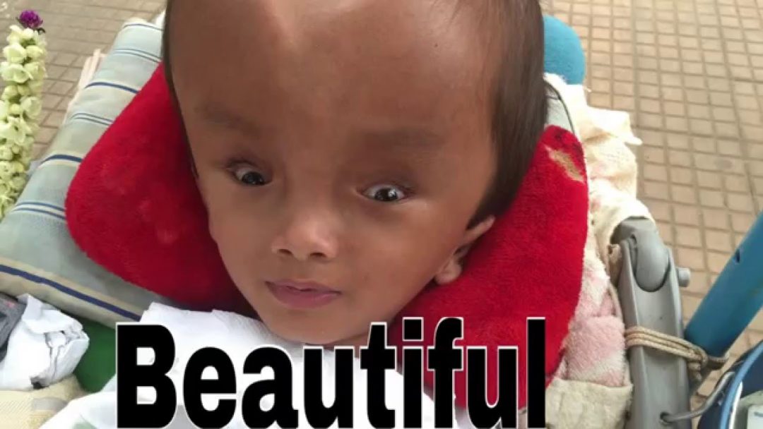 Cambodia's Killing Fields: Alien Baby Boy Battambang, Phnom Penh,Siem ...